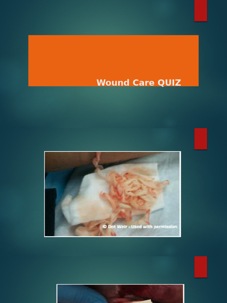 Types of Wound Quiz | PDF