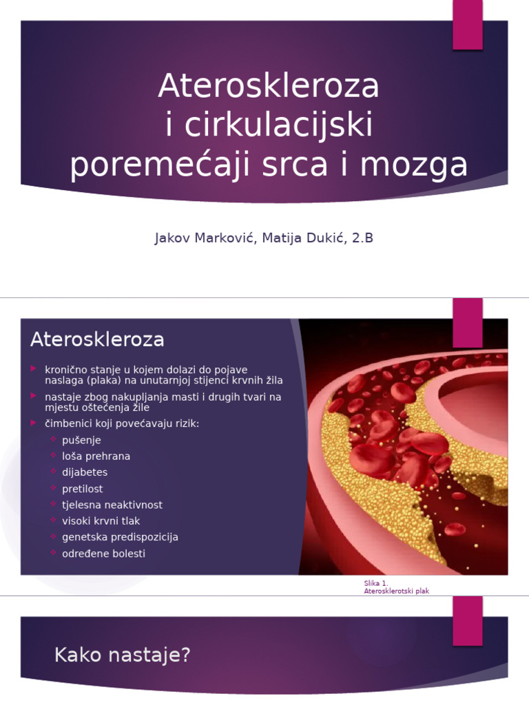 Ateroskleroza I Cirkulacijski Poremećaji Srca I Mozga | PDF