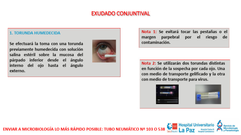 Exudado Conjuntival | PDF