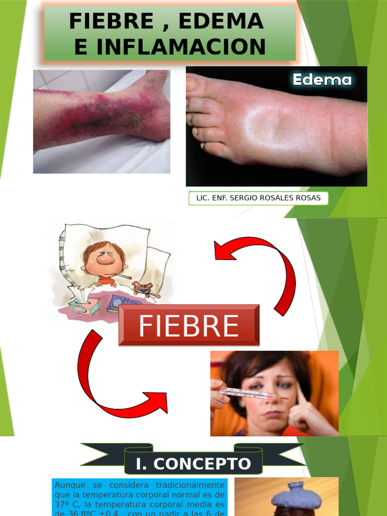 Clase Edema, Fiebre e Inflamacion | PDF | Inflamación | Edema