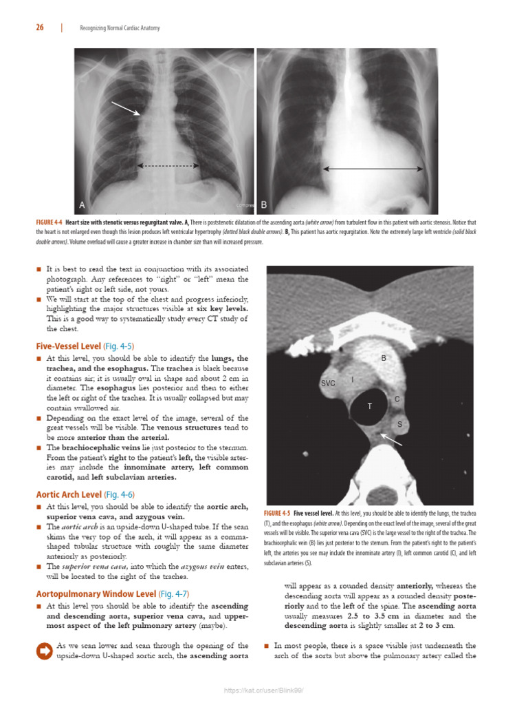 Cardiac Level Dari Learning | PDF | Coronary Circulation | Aorta