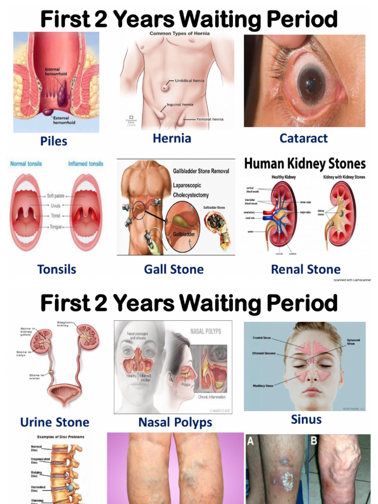 Two Years Waiting Period | PDF