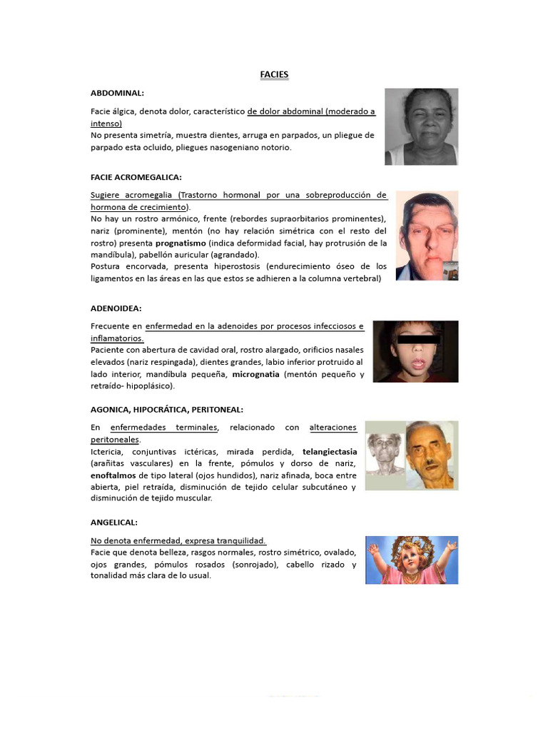 Tipos de Facies y sus Características | PDF | Cara | Hipertiroidismo