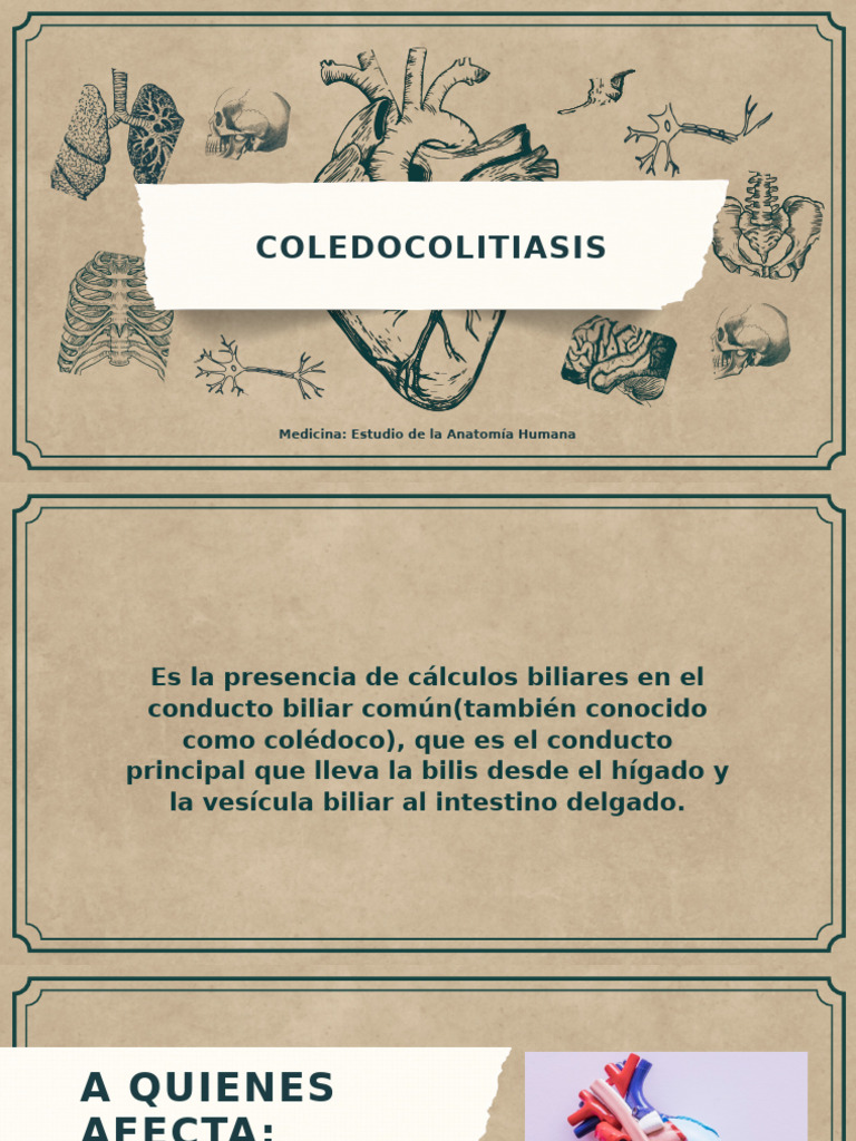 COLEDOCOLITIASIS | PDF