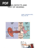 Paracusis Willisii in Otosclerosis Explained | PDF | Hearing Loss | Hearing