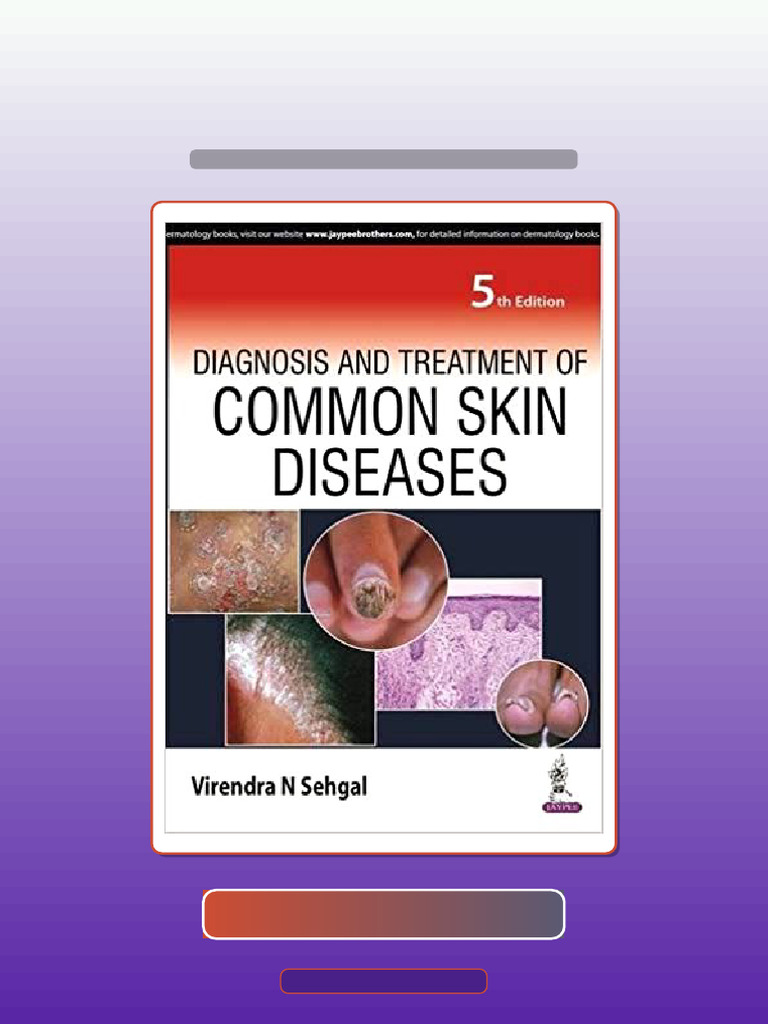 Diagnosis and Treatment of Common Skin Diseases 5th Edition by Sehgal Virendra N | PDF ...