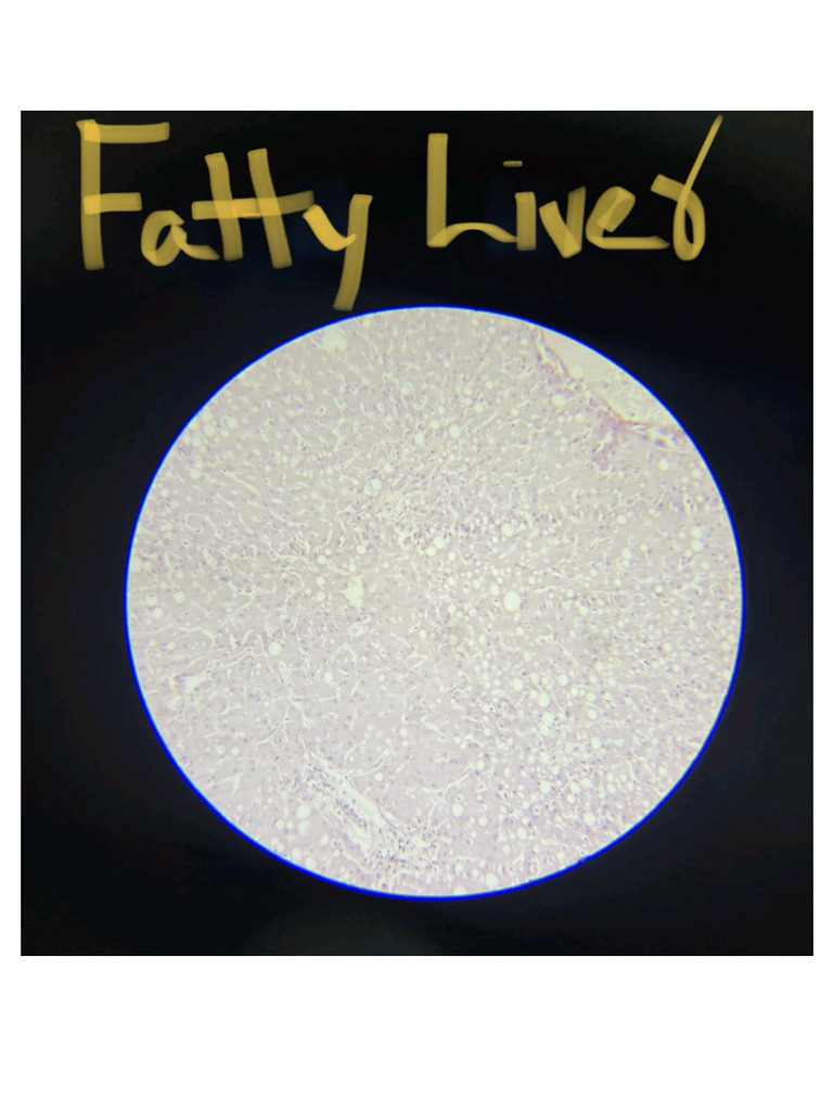 Histopathology Slide CH63 | PDF