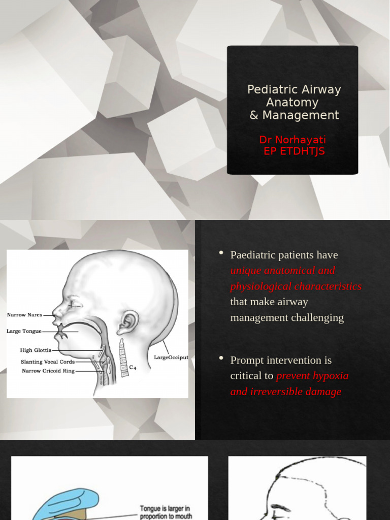 Pediatric Airway Anatomy & Management 2025 | PDF | Respiratory Tract ...