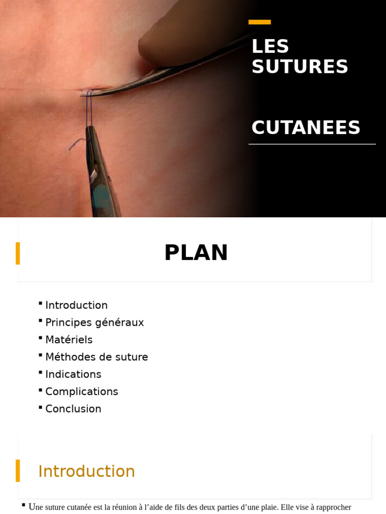Les Sutures | PDF | Suture (médecine)