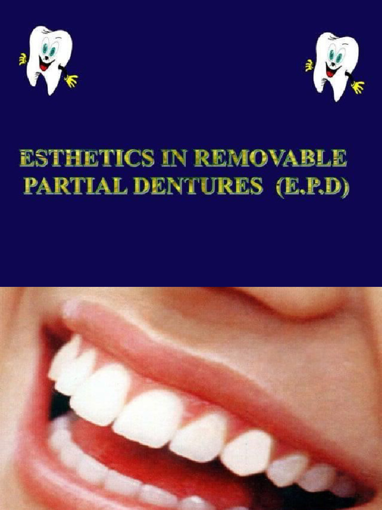 Esthetic in RPD | PDF