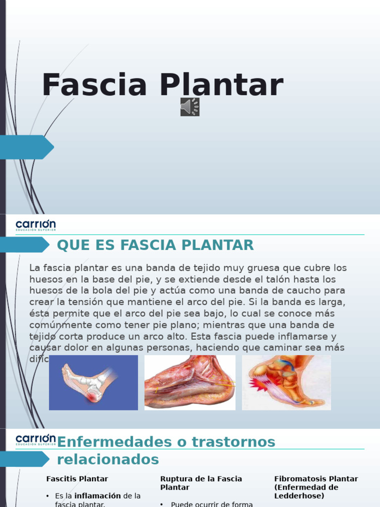 Fascia Plantar | PDF | Enfermedades y trastornos humanos | Medicina CLINICA