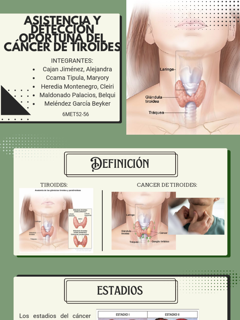 Detección y Estadios del Cáncer de Tiroides | PDF