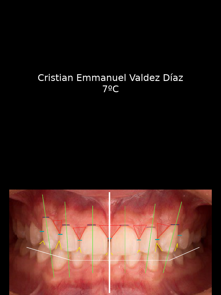 Caso 1 DSD Power | PDF