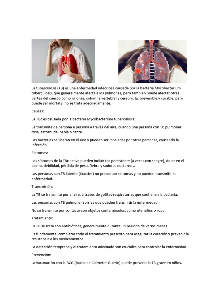 Tuberculosis: causas, síntomas y tratamiento | PDF