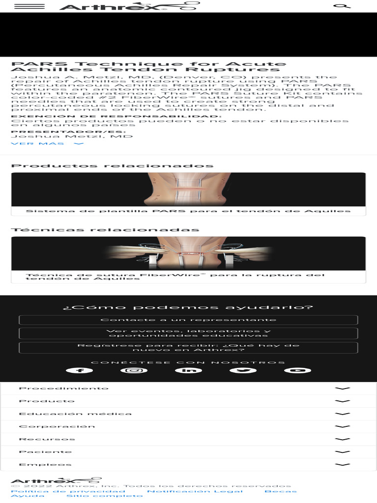Arthrex - PARS Technique For Acute Achilles Tendon Ruptures | PDF