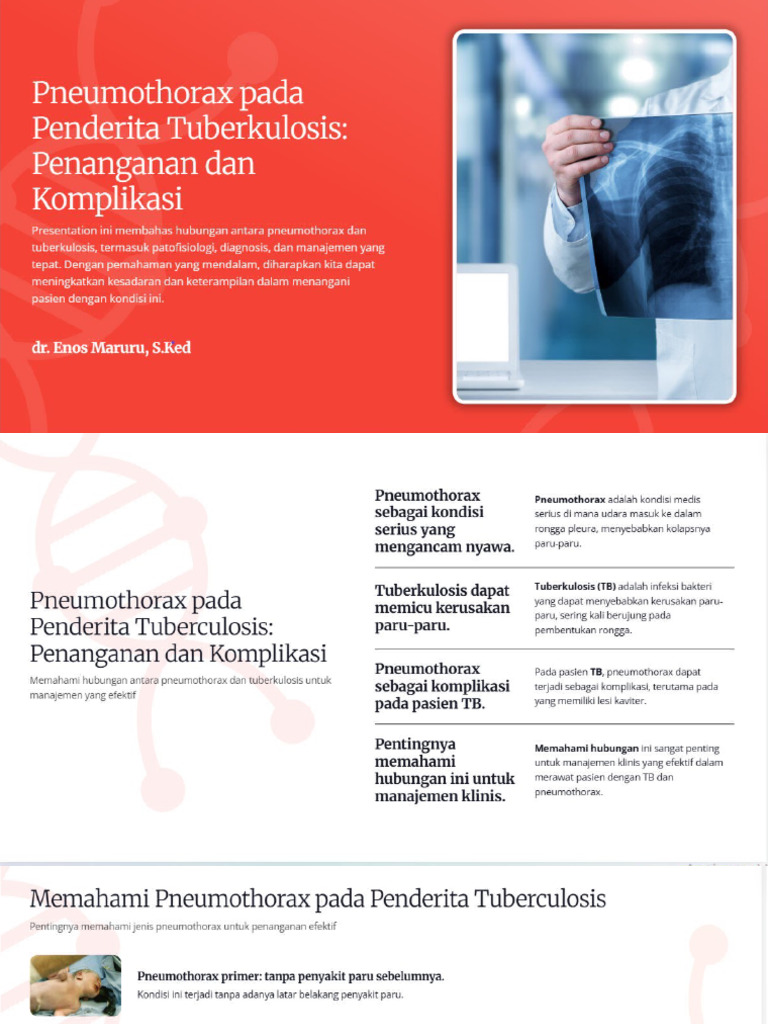 Pneumothorax Pada Pasien TB | PDF