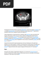 Abdominal Exam Techniques for Appendicitis | PDF