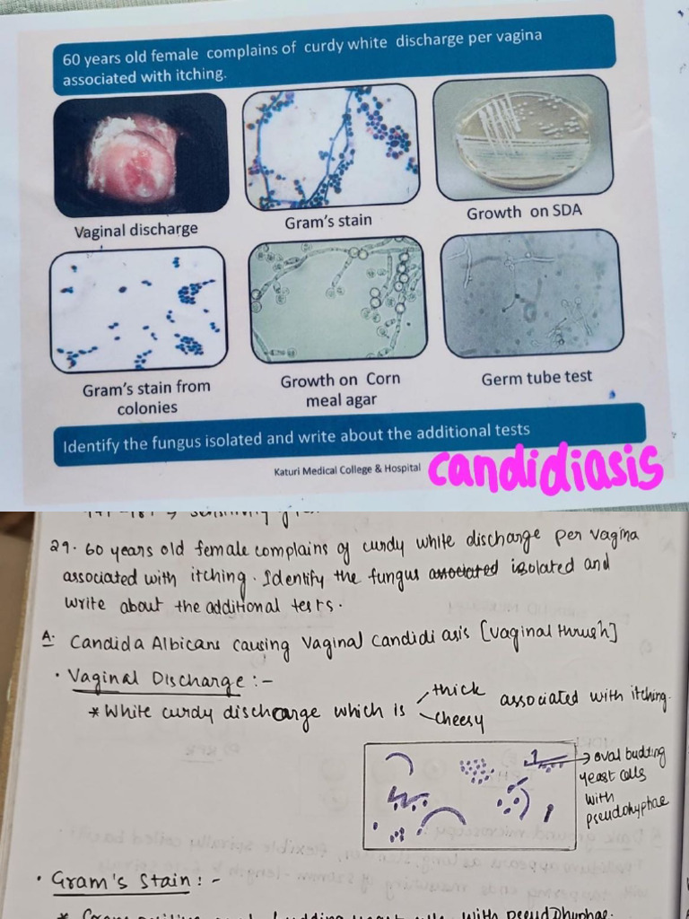 Mycology Microbiology VIVA Charts | PDF