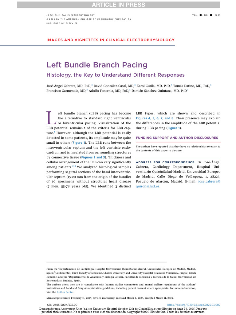 Left Bundle Branch Pacing | PDF | Heart Valve | Coronary Circulation