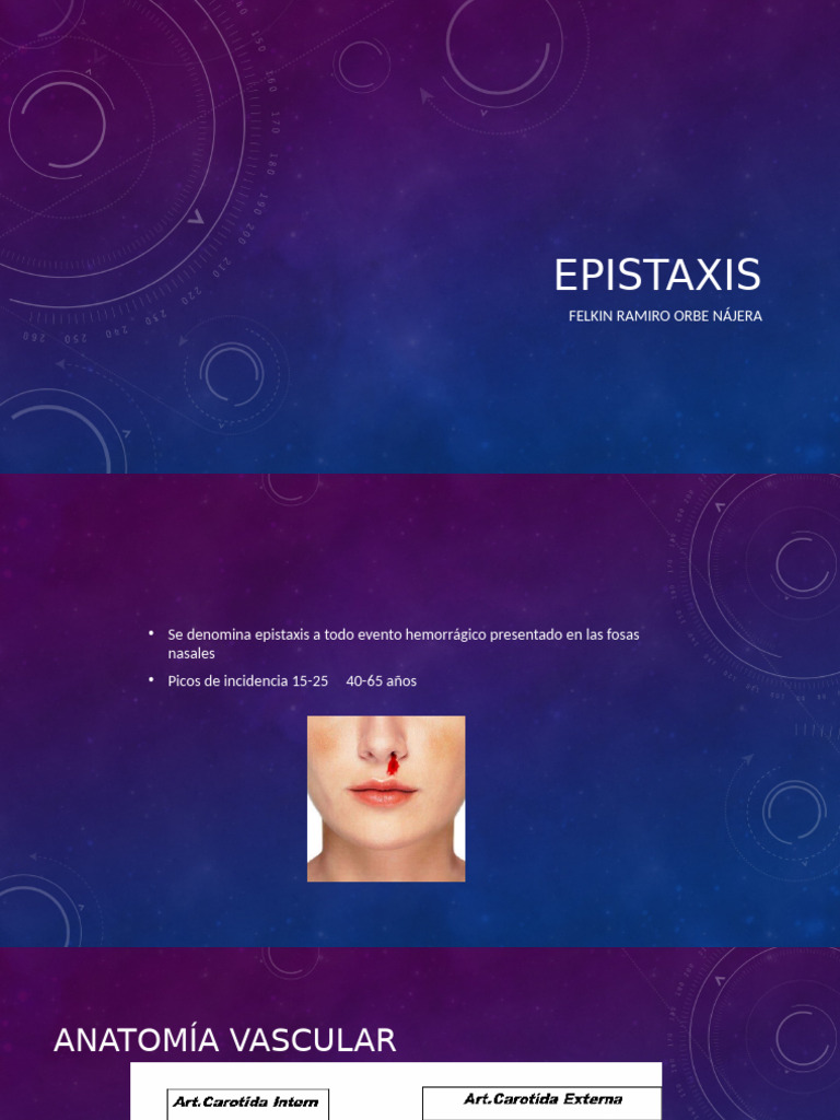 Epistaxis | PDF | Alergia | Asma