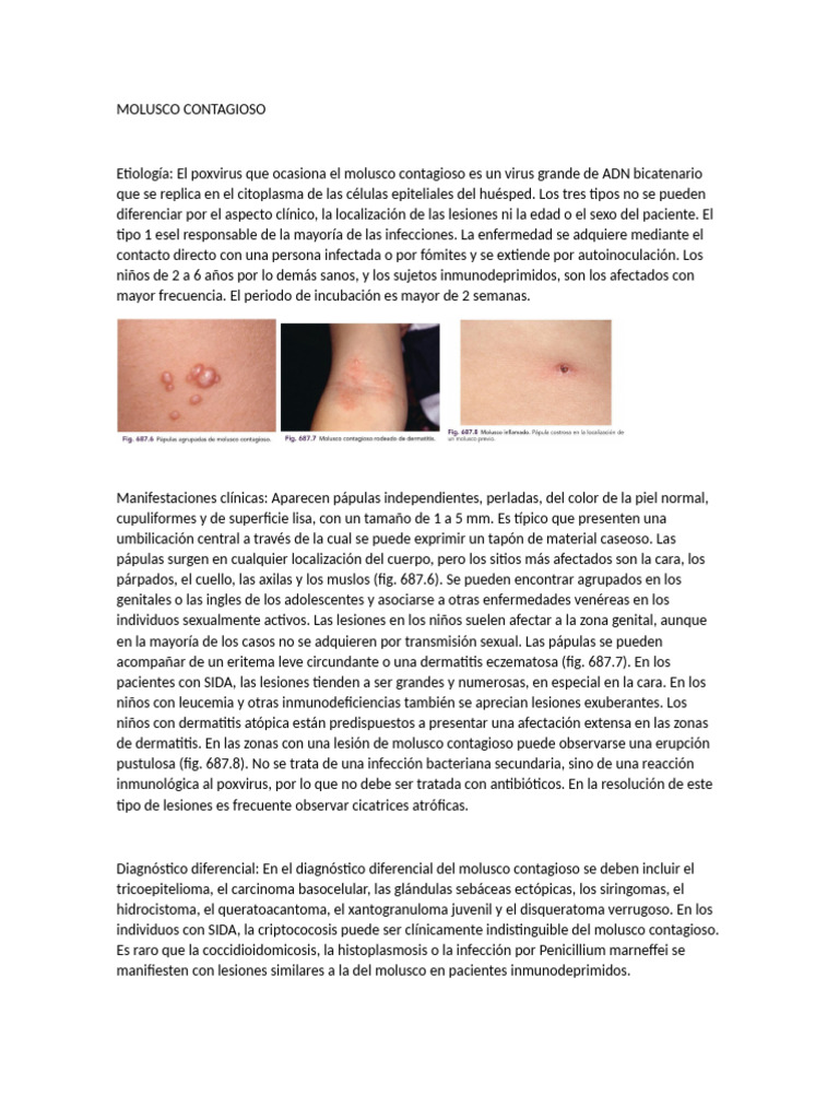 Molusco Contagioso: Causas y Tratamiento | PDF | Candidiasis ...