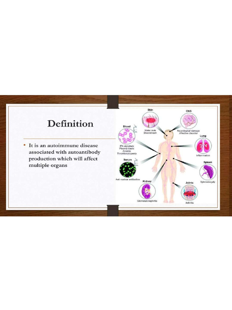 Systemic Lupus Erythematosus | PDF