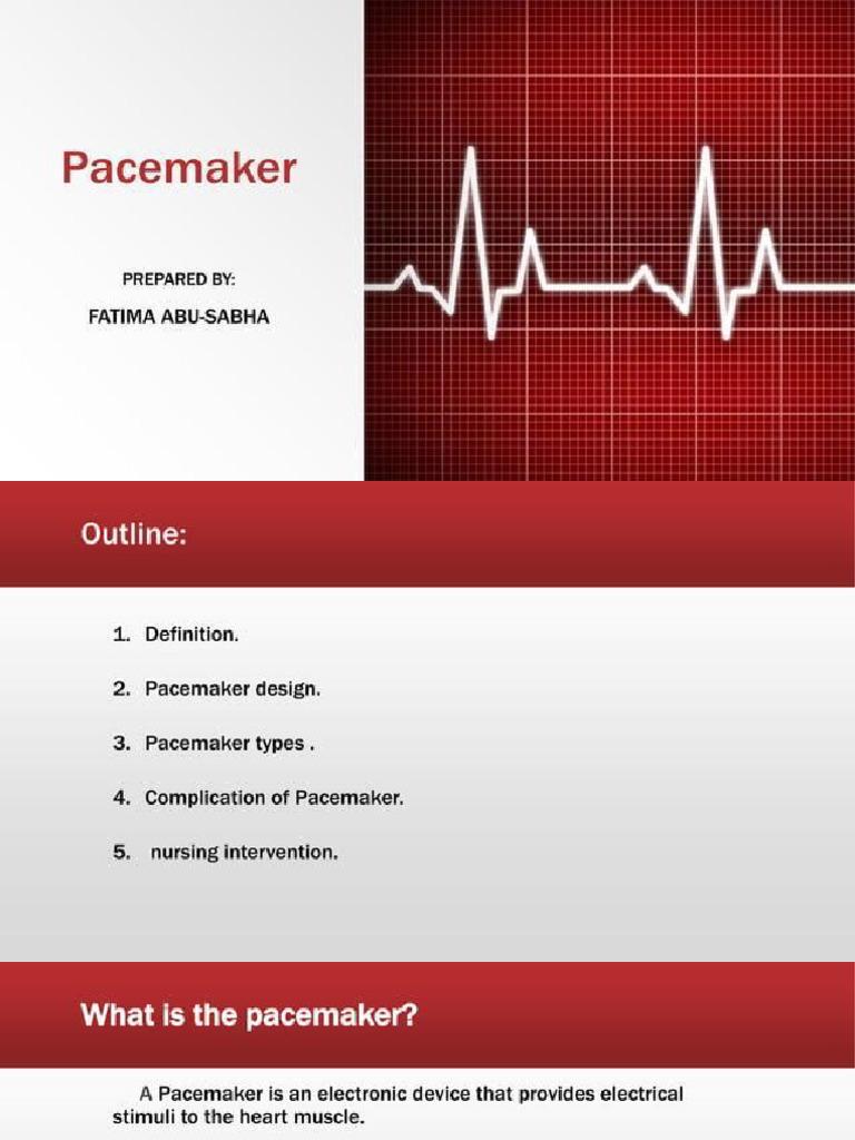 Pacemaker | PDF