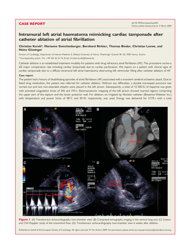 Intramural Left Atrial Haematoma Case Report | PDF | Cardiology ...