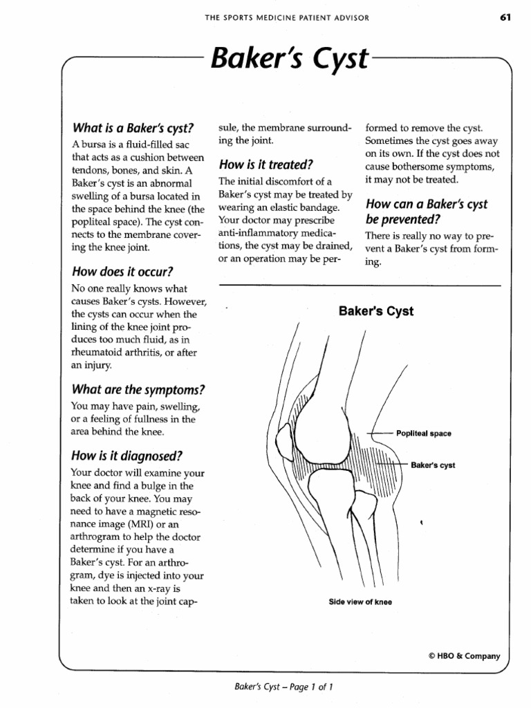 130 - Bakers Cyst | PDF