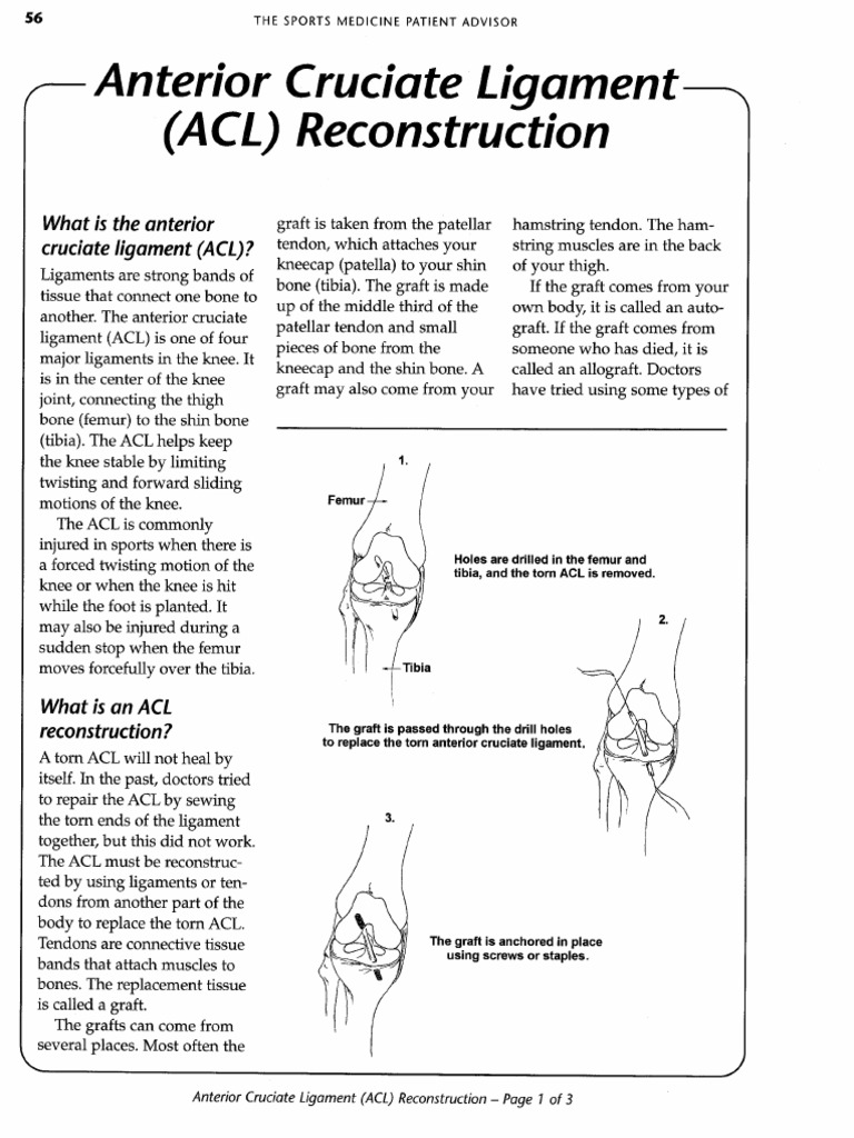 129 - Acl Reconstruction | PDF
