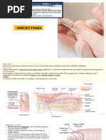 Matricectomía: Técnicas y Consideraciones | PDF | Clavo (anatomía ...
