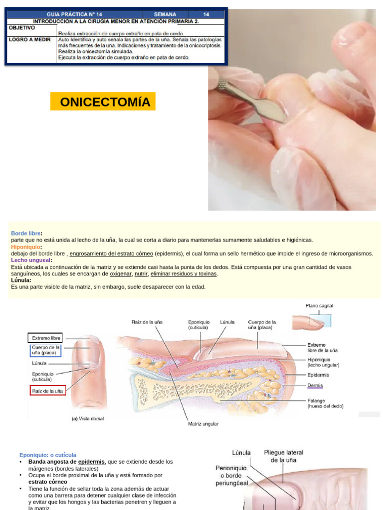 Practica 14 Onicectomía | PDF | Clavo (anatomía) | Epidermis