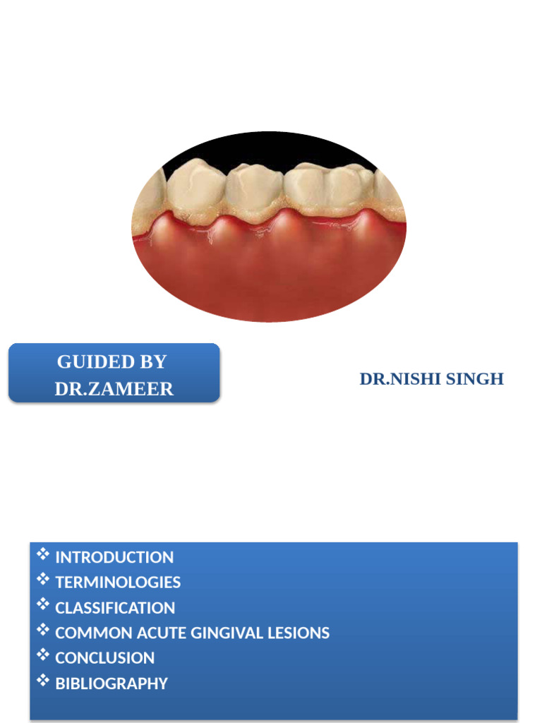 Acute Gingival Lesions | PDF | Candidiasis | Periodontology