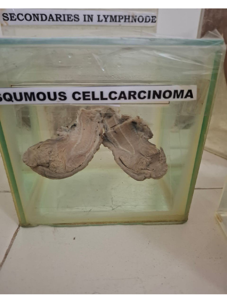 Pathology - Gross | PDF