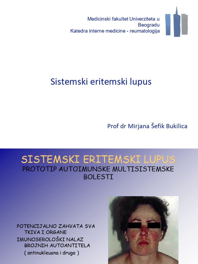 Predavanje Lupus I APS | PDF