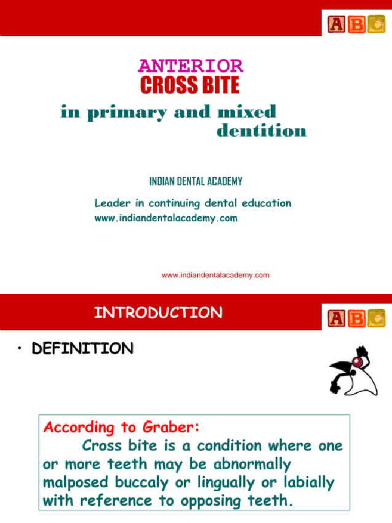 Anterior Cross Bite | PDF