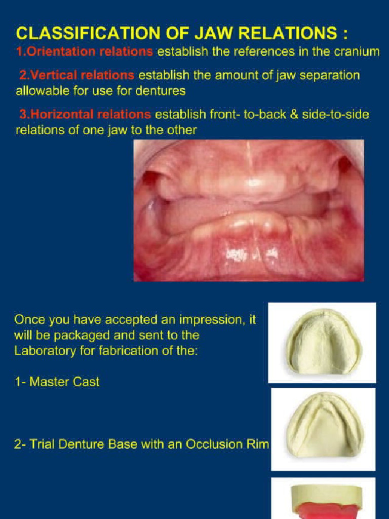 Classification of Jaw Relation | PDF