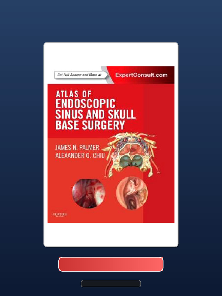 Atlas of Endoscopic Sinus and Skull Base Surgery Test Bank Available ...
