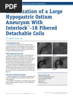 Medtronic - CONCERTO - Embolization Coils | PDF | Helix | Materials
