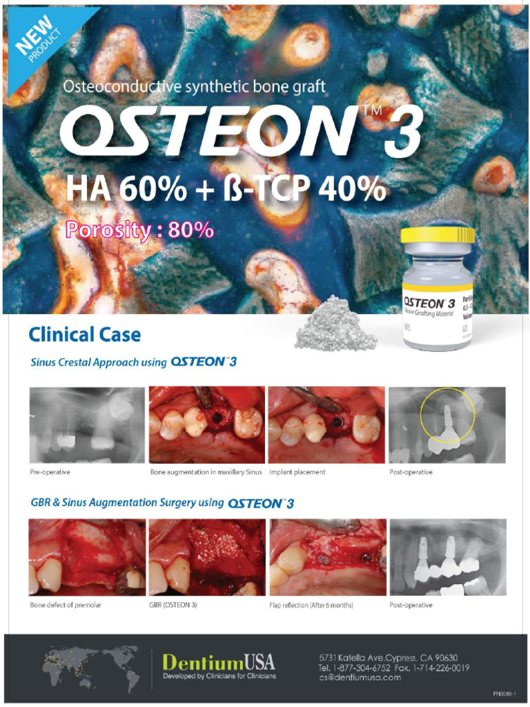 Osteon 3 | PDF