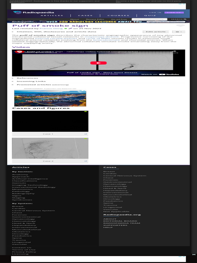 Puff of Smoke Sign Radiology Reference Article | PDF | Interventional ...