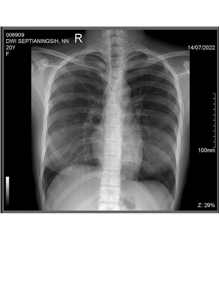 Thorax | PDF