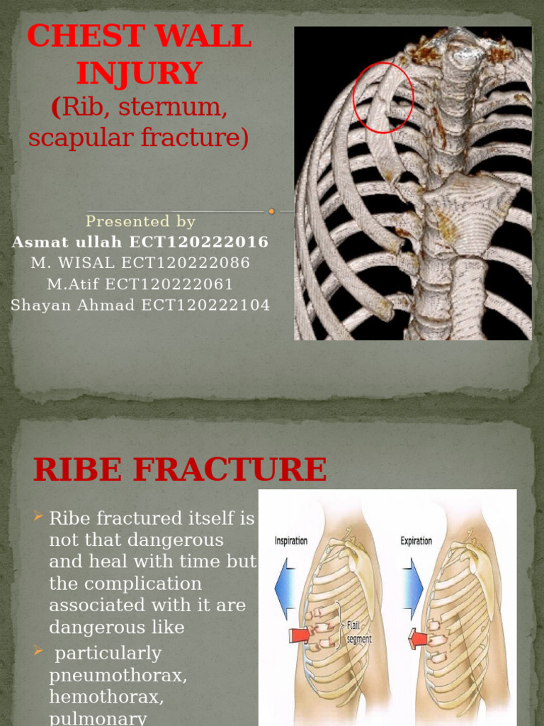 CHEST WALL INJURY Made by Asmat Ullah | PDF | Thorax | Shoulder