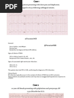 Understanding Delta Waves in ECG | PDF | Medical Specialties | Causes ...