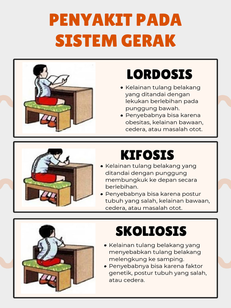 Poster Penyakit Pada Sistem Gerak | PDF