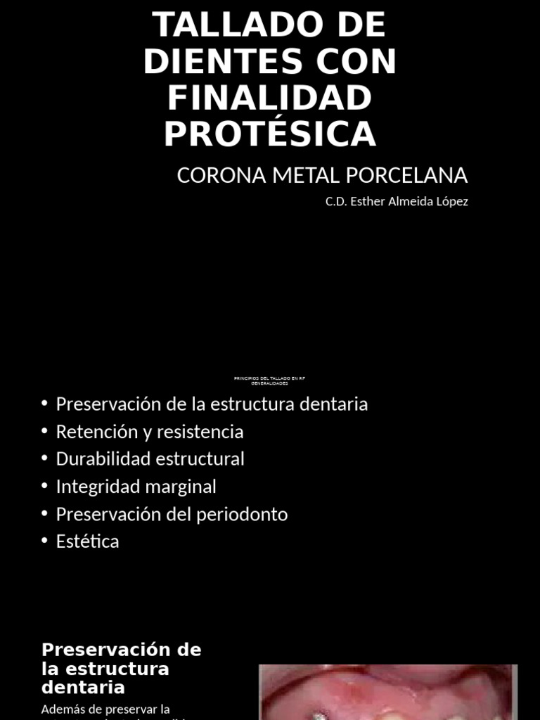 SEMANA 2 TALLADO DE DIENTES CON FINALIDAD PROTÉSICA Corona Metal ...