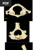 Musculos de La Nuca | PDF | Anatomía humana | Sistema musculoesquelético