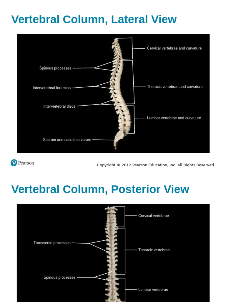PAL3 Models Axial Vertebral LBL Accessible | PDF | Vertebra | Vertebral Column