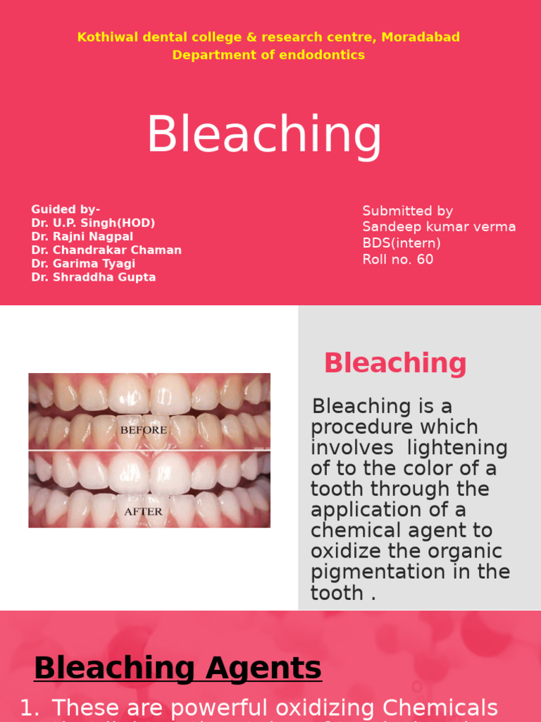 Classification of Bleaching Techniques | PDF | Human Tooth | Bleach