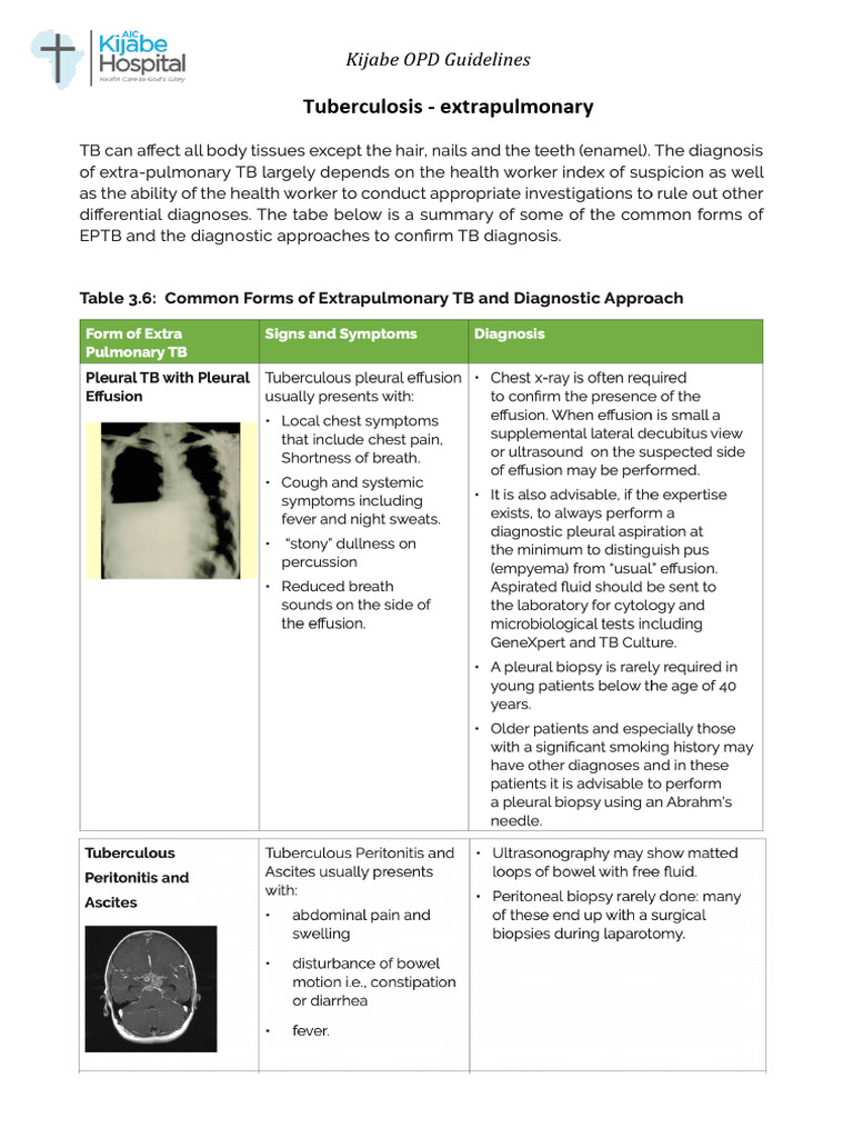 TB - Extrapulmonary | PDF